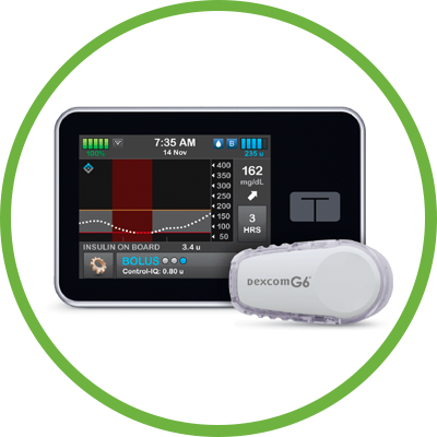 Technology & Innovation - Dexcom - DigiBete